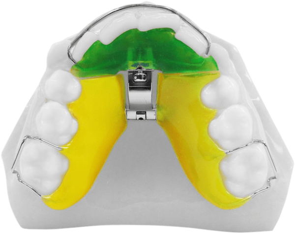 Active Plates and Splints | Ricoh Orthodontic Appliances