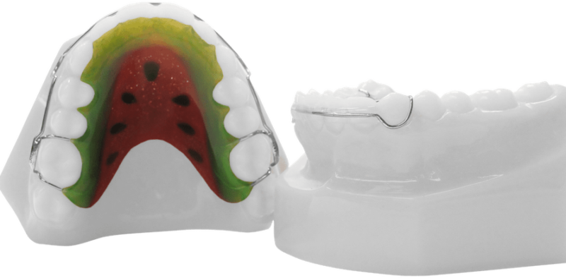 Retainers | Ricoh Orthodontic Appliances