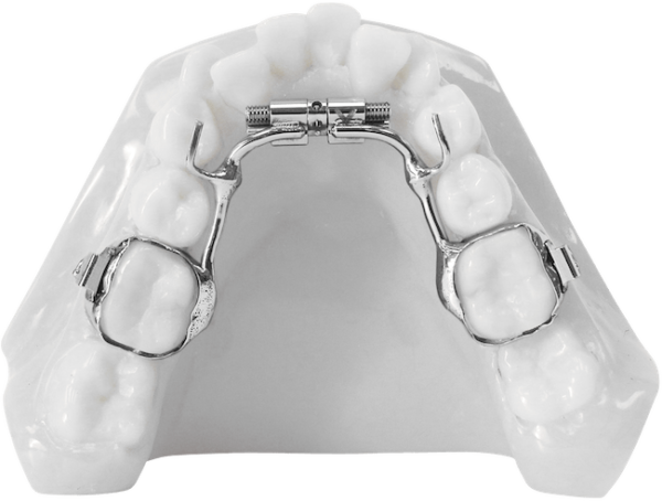 Fixed Appliances | Ricoh Orthodontic Appliances