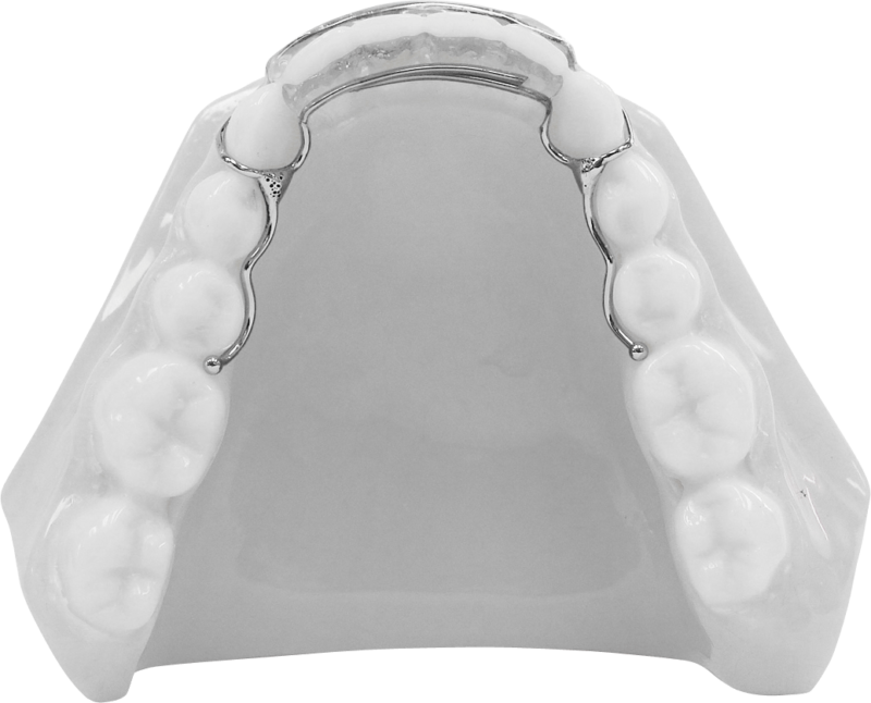Retainers | Ricoh Orthodontic Appliances
