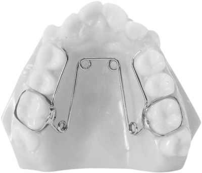 Fixed Appliances | Ricoh Orthodontic Appliances