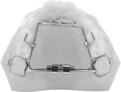 Fixed Appliances | Ricoh Orthodontic Appliances