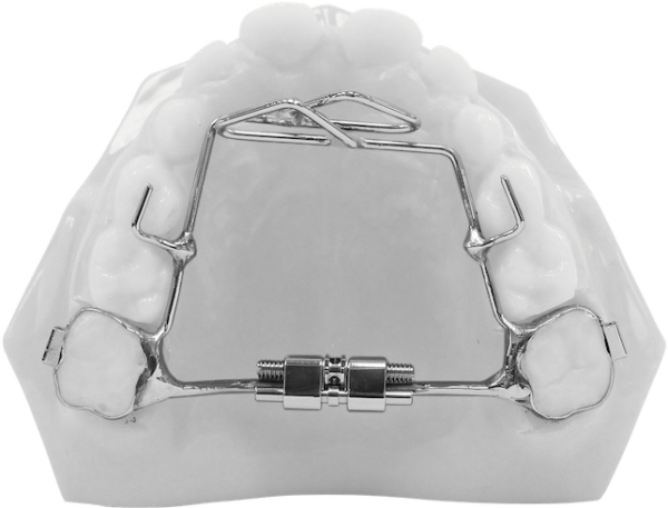 Fixed Appliances | Ricoh Orthodontic Appliances